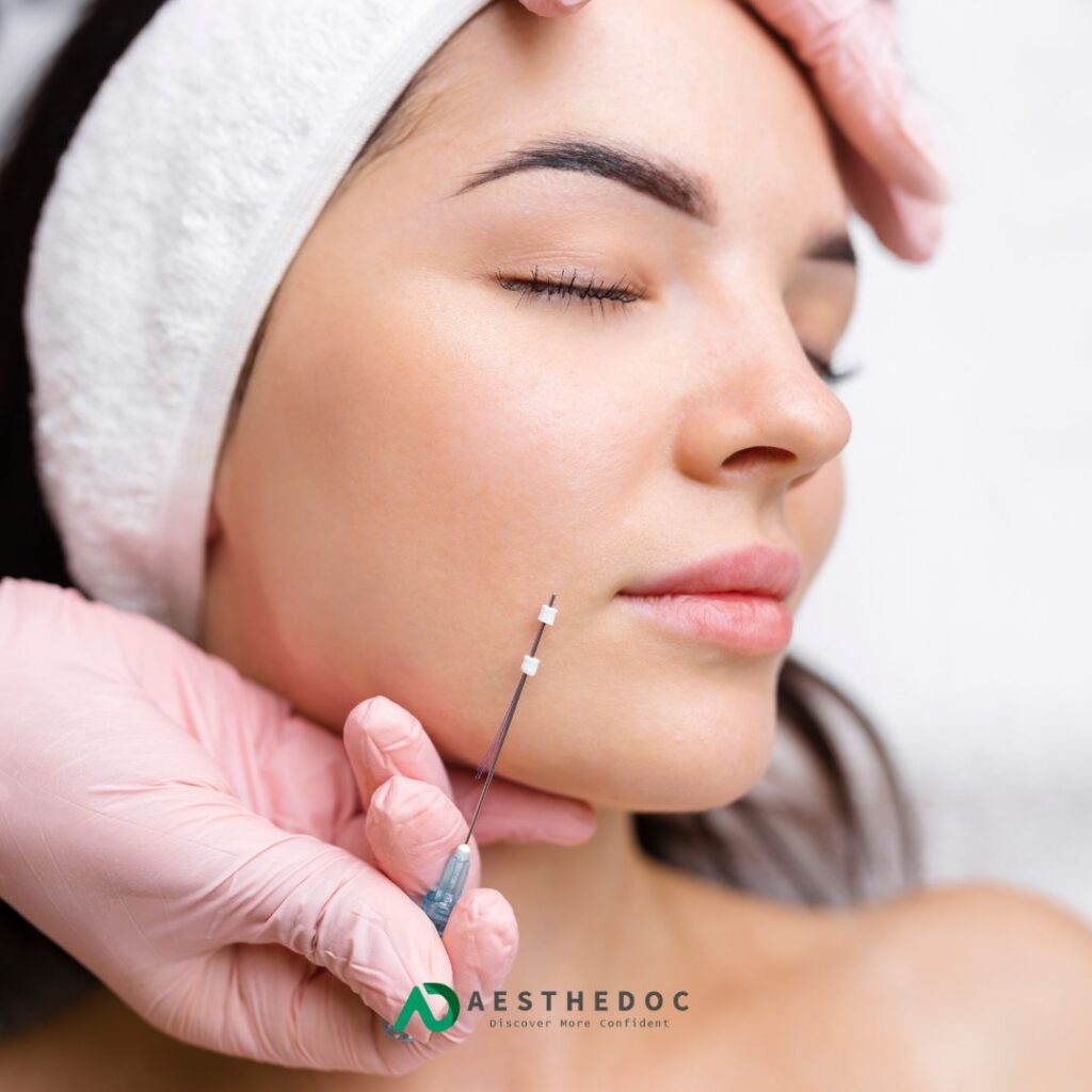 Facelift Threads - Aesthedoc Clinic