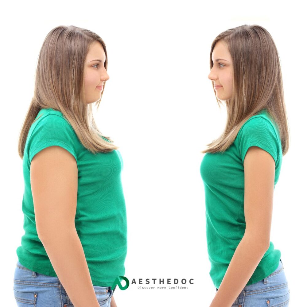 Slimming Drips IV Therapy - Weight Loss Clinic Pakistan