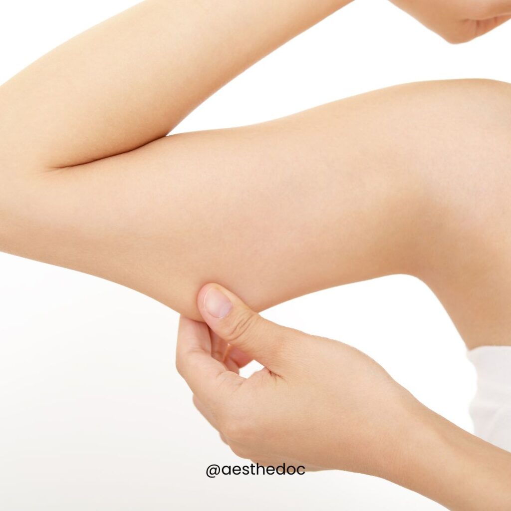 Arm Lift Non Surgical in Islamabad, Aesthedoc