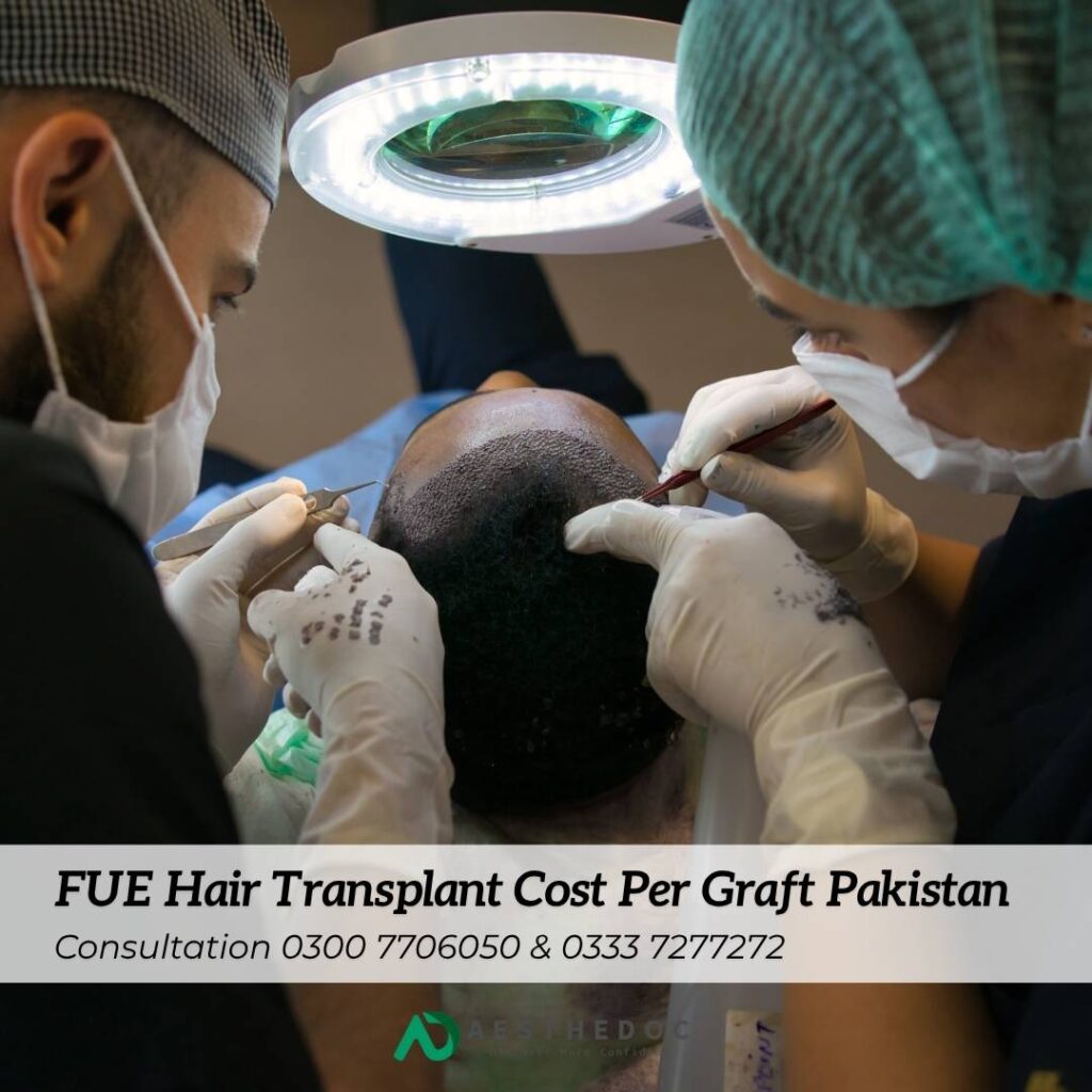 FUE Hair Transplant Cost Per Graft in Pakistan | Aesthedoc