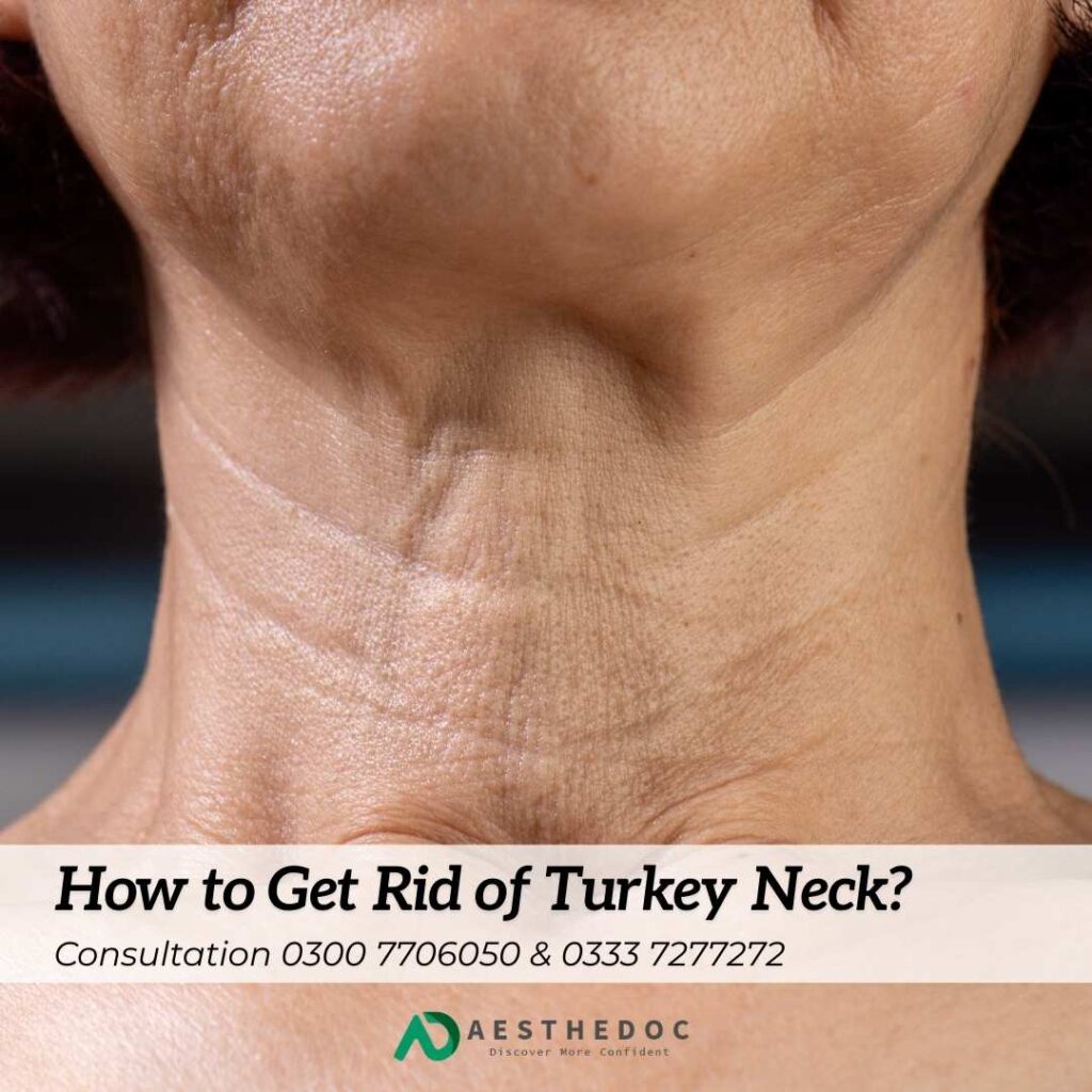 How to Get Rid of Turkey Neck | Tightening Treatments