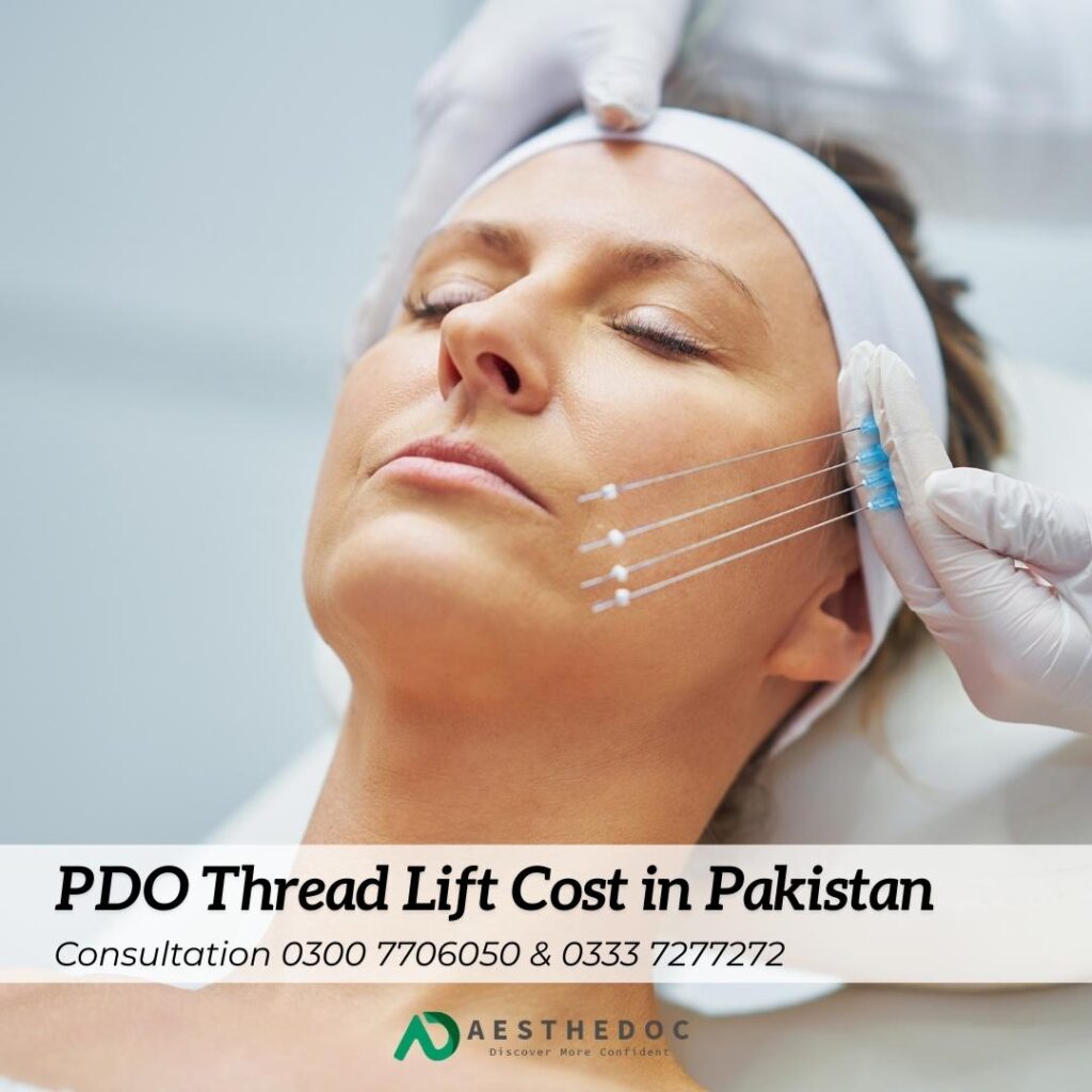 PDO Thread Lift Cost in Pakistan | Aesthedoc Clinic